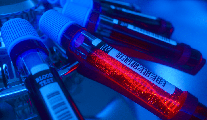 Labcorp Plasma Focus | Labcorp Oncology